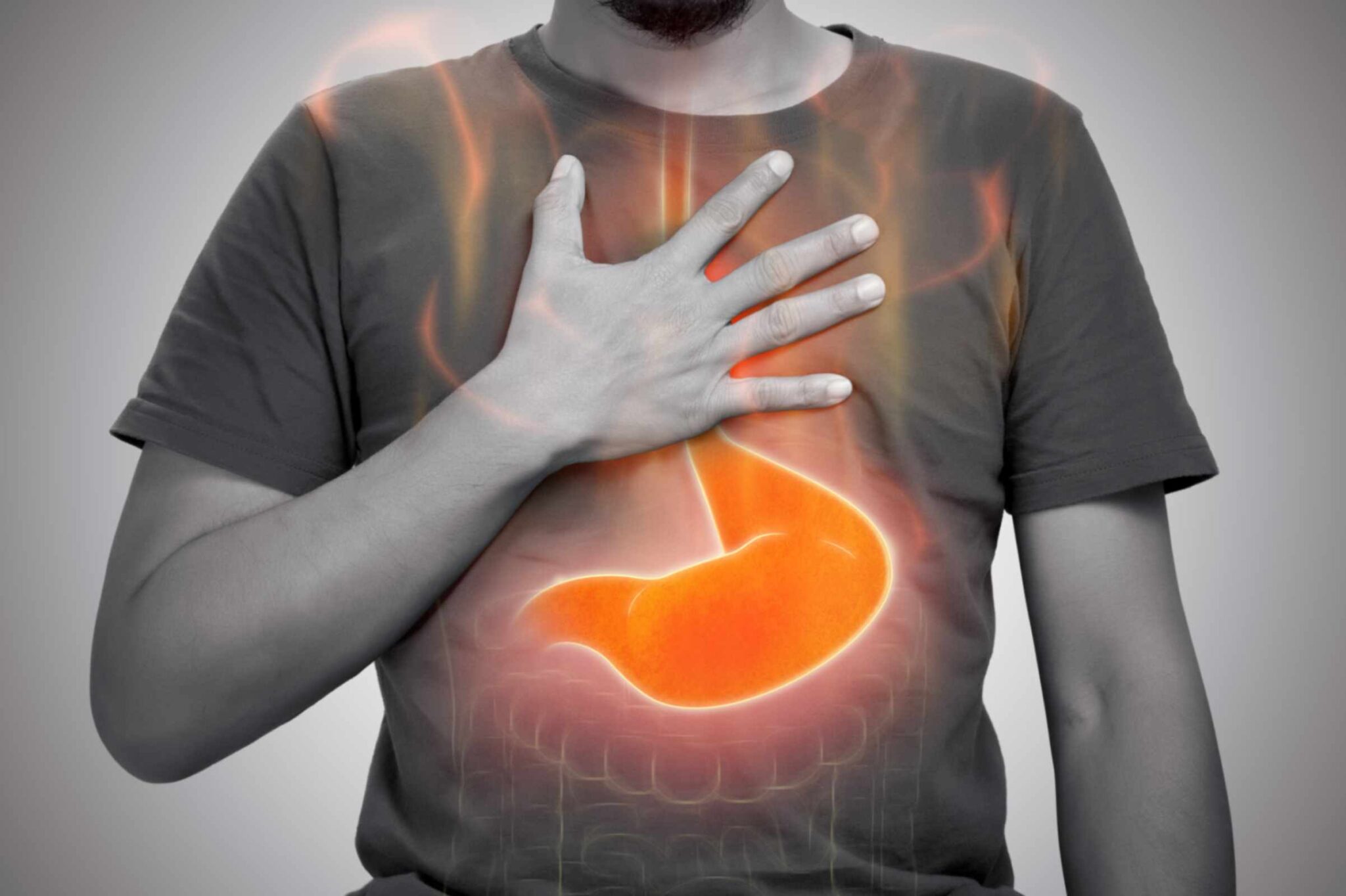 What are the Causes, Symptoms, and Treatment for Acidity