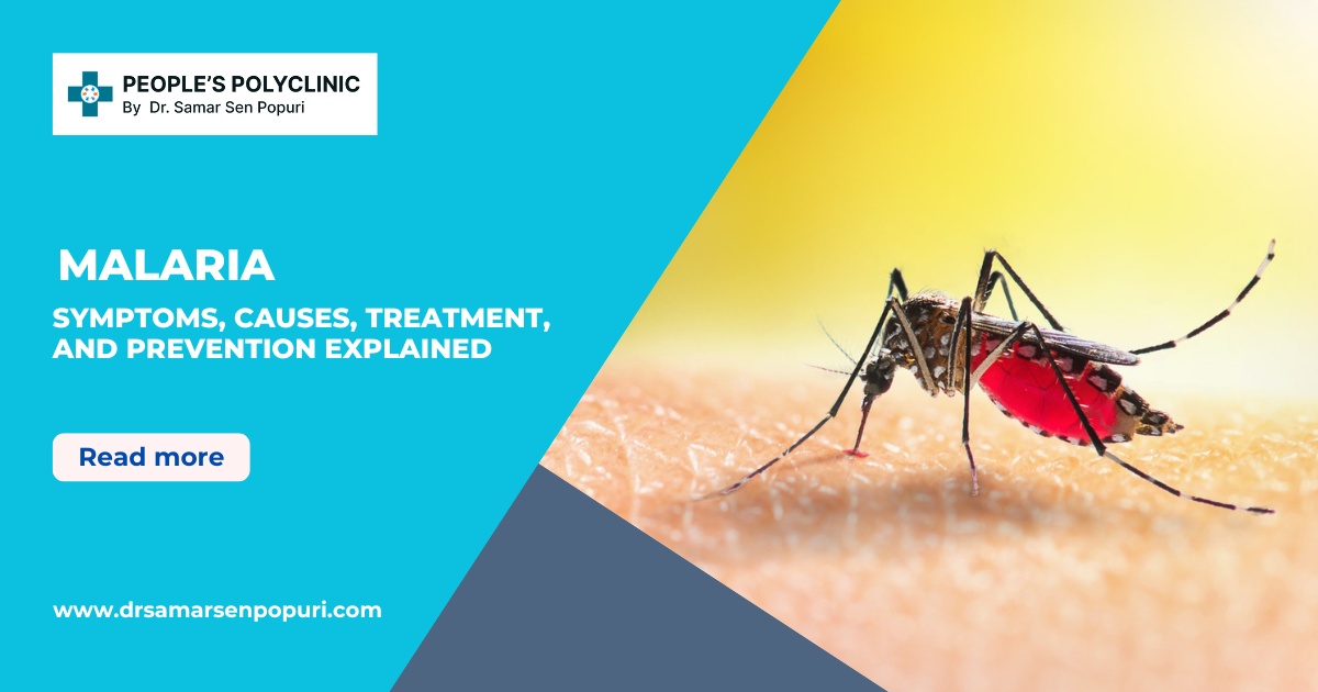 Malaria Symptoms, Causes, Diagnosis & Treatment